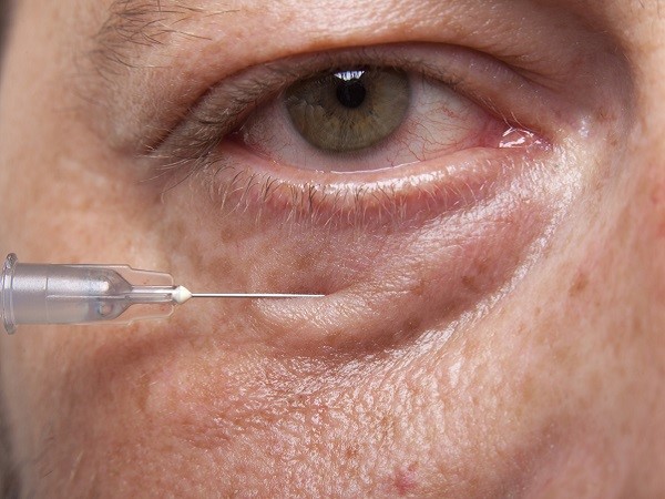 Bótox: Botulinum Toxin - Belleza y bienestar